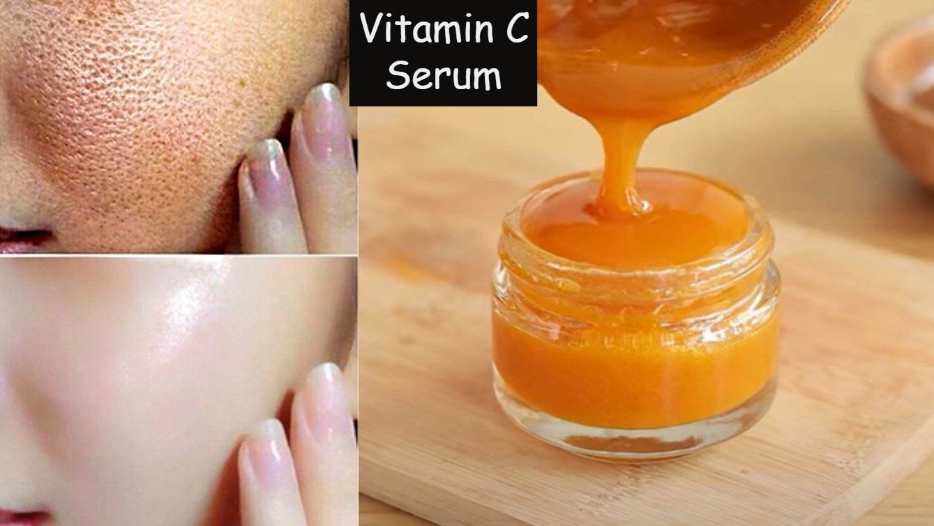 Homemade Vitamin C Serum | DIY Vitamin C Serum for Clear Skin